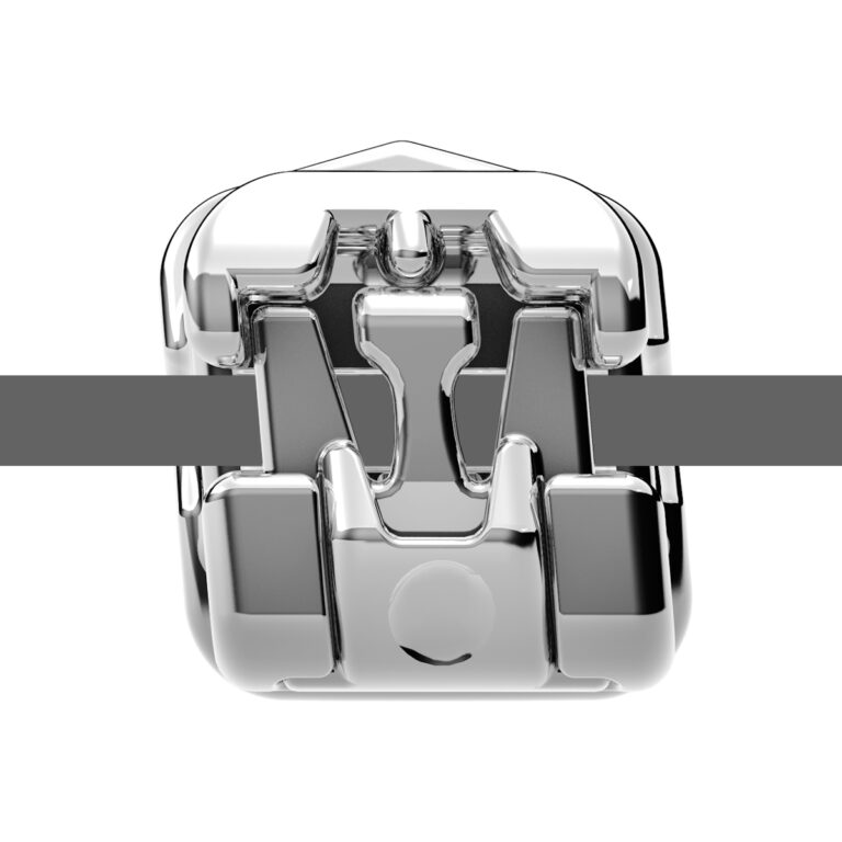 What Is Pitts21 Bracket System | Pobanz Orthodontics Ogden